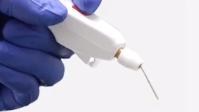 Technique Plasma PLEX'R | Docteur Jean-Pascal Reynaud